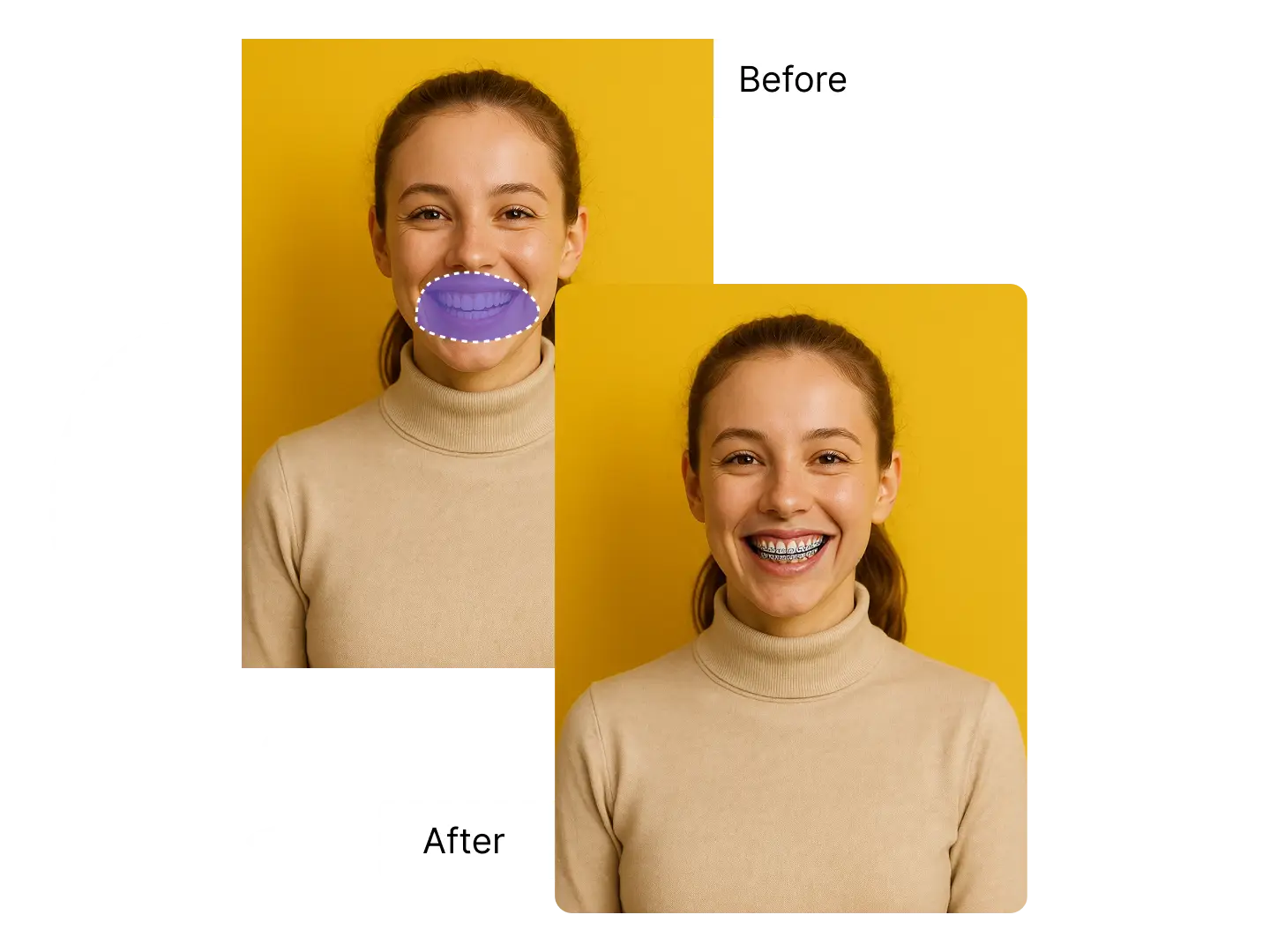Braces Filter on Dzine AI - Virtual Braces Try on